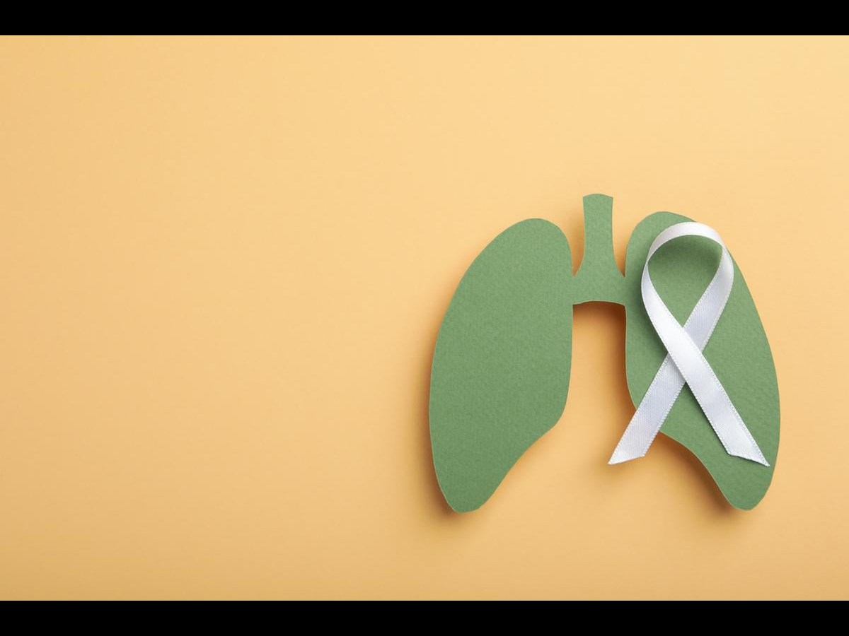 American Lung Association Releases Annual 'State of Lung Cancer' Repor American Lung Association Releases Annual 'State of Lung Cancer' Repor